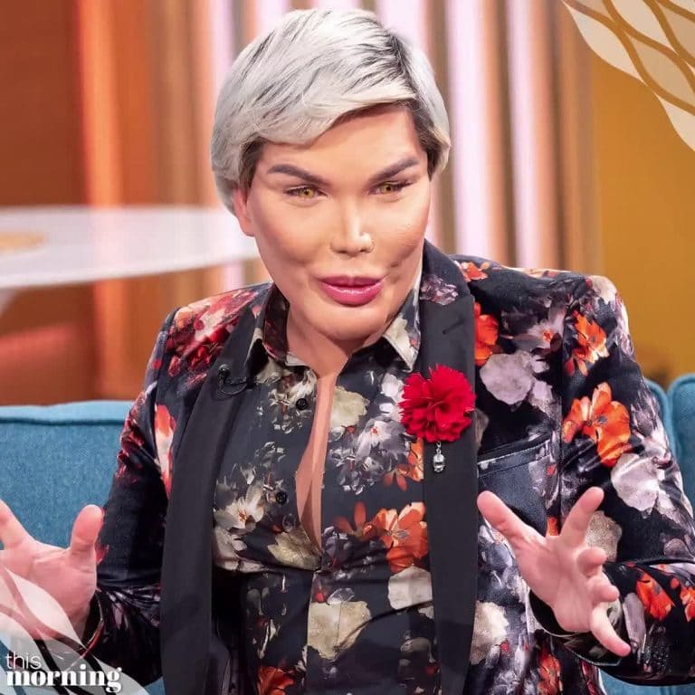 Rodrigo Alves Has FOUR Ribs Removed | HOOKED ON THE LOOK Free Content ...
